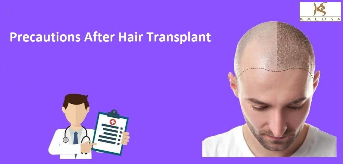 Post Operative Care And Precautions After Hair Transplant